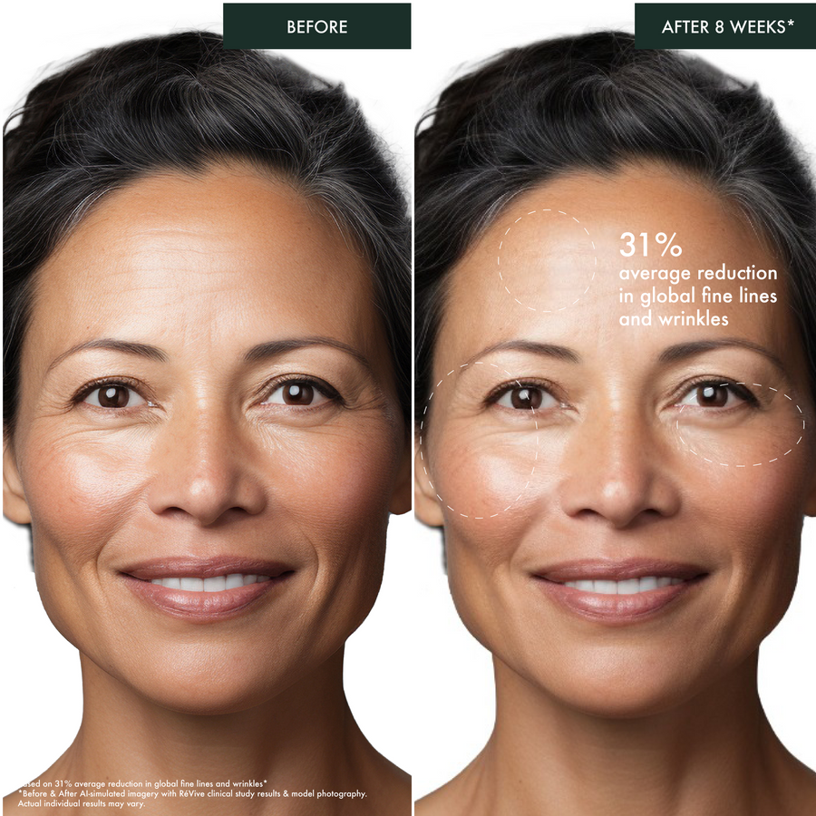 Rescue Elixir | Anti Aging Oil | Murumuru Butter | ReVive Skincare ...